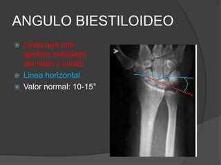 Mediciones radiograficas codo | PPTX