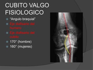 Mediciones radiograficas codo | PPTX