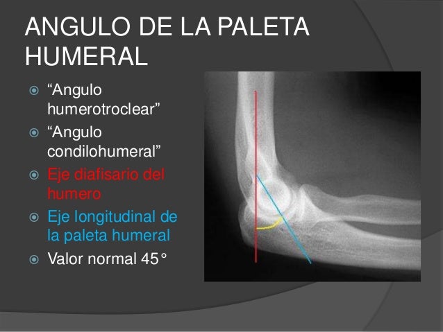 Mediciones radiograficas codo