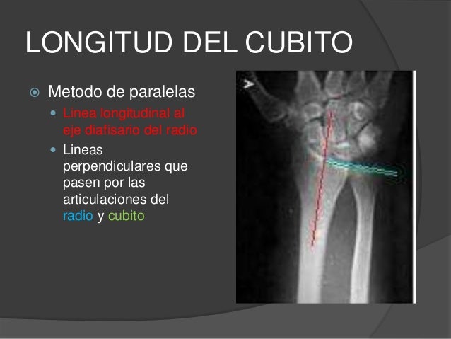 Mediciones radiograficas codo
