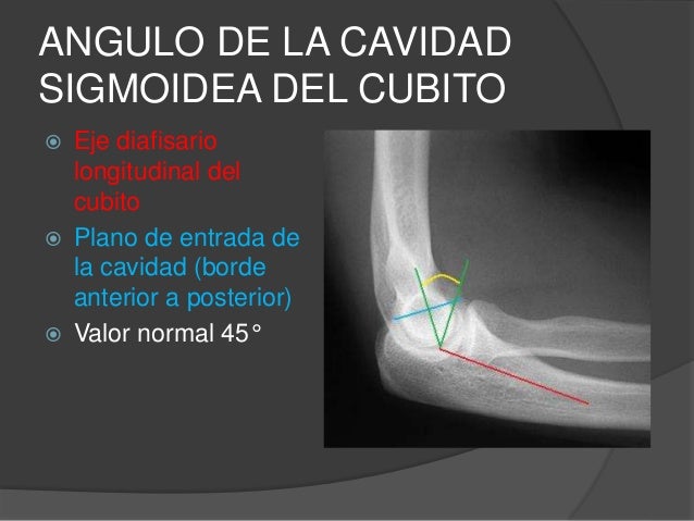 Mediciones radiograficas codo