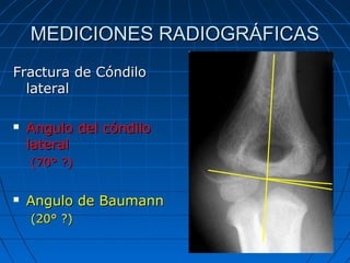 Mediciones radiográficas de miembro torácico | PPT
