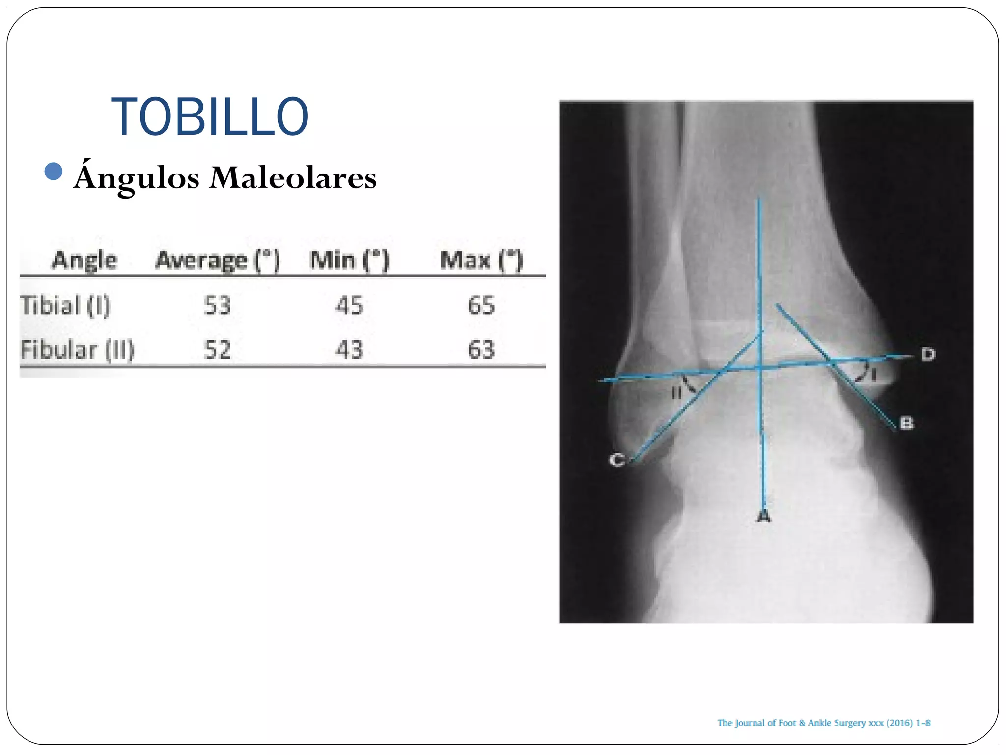 Mediciones Radiográficas de Tobillo | PPT