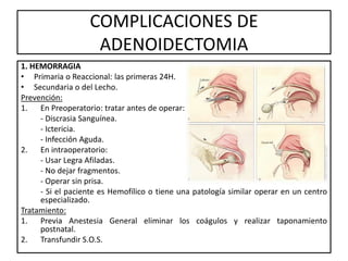 Adenotonsilectomia | PPTX