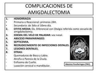 Adenotonsilectomia | PPTX