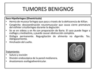 Adenotonsilectomia | PPTX