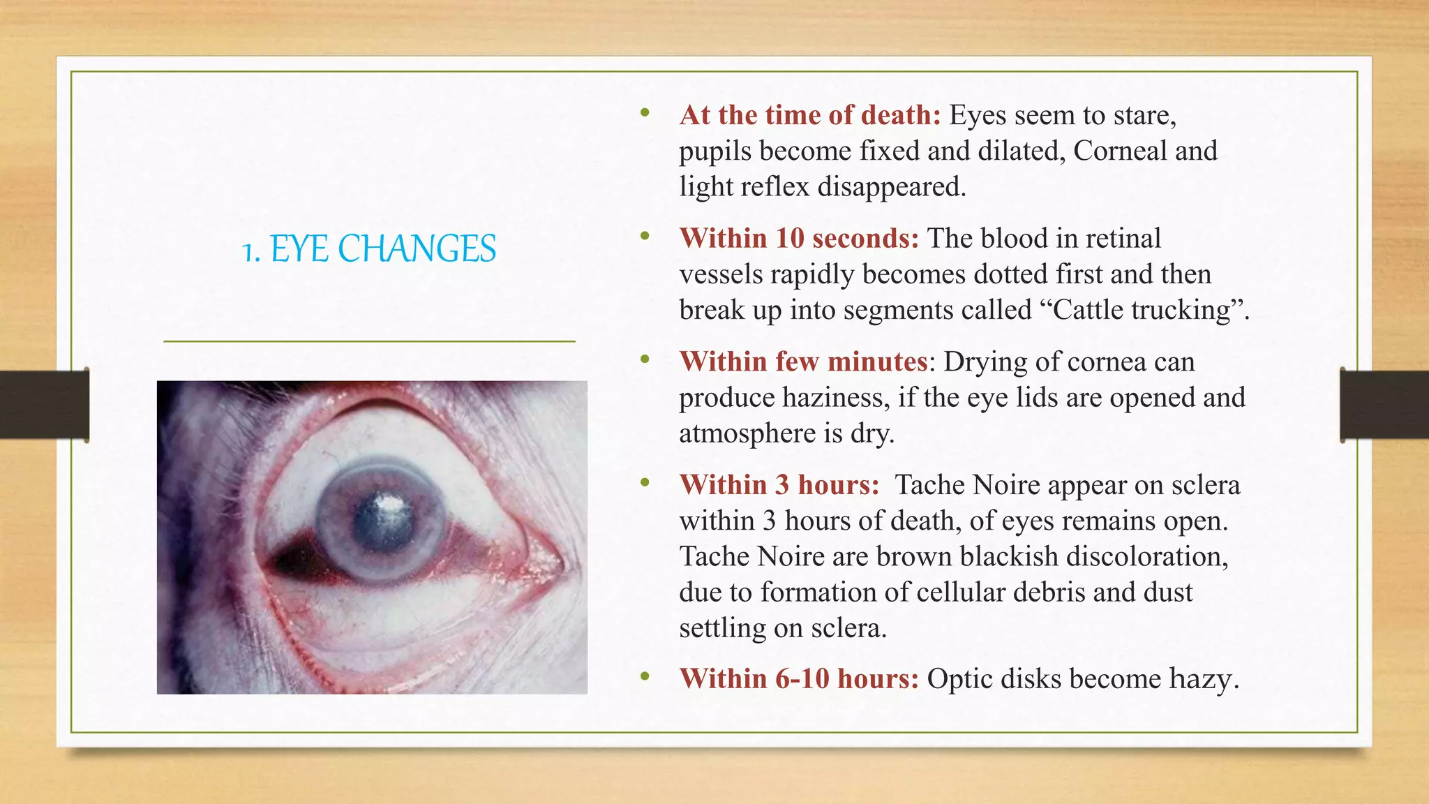 Medicolegal aspects of death | PPTX