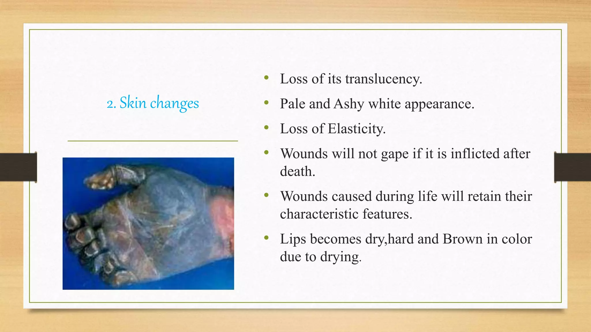 Medicolegal aspects of death | PPTX