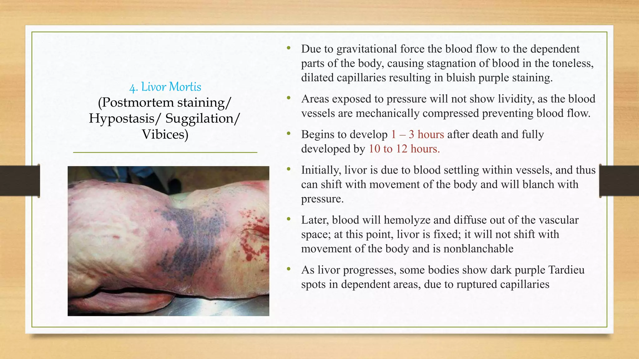 Medicolegal aspects of death | PPTX