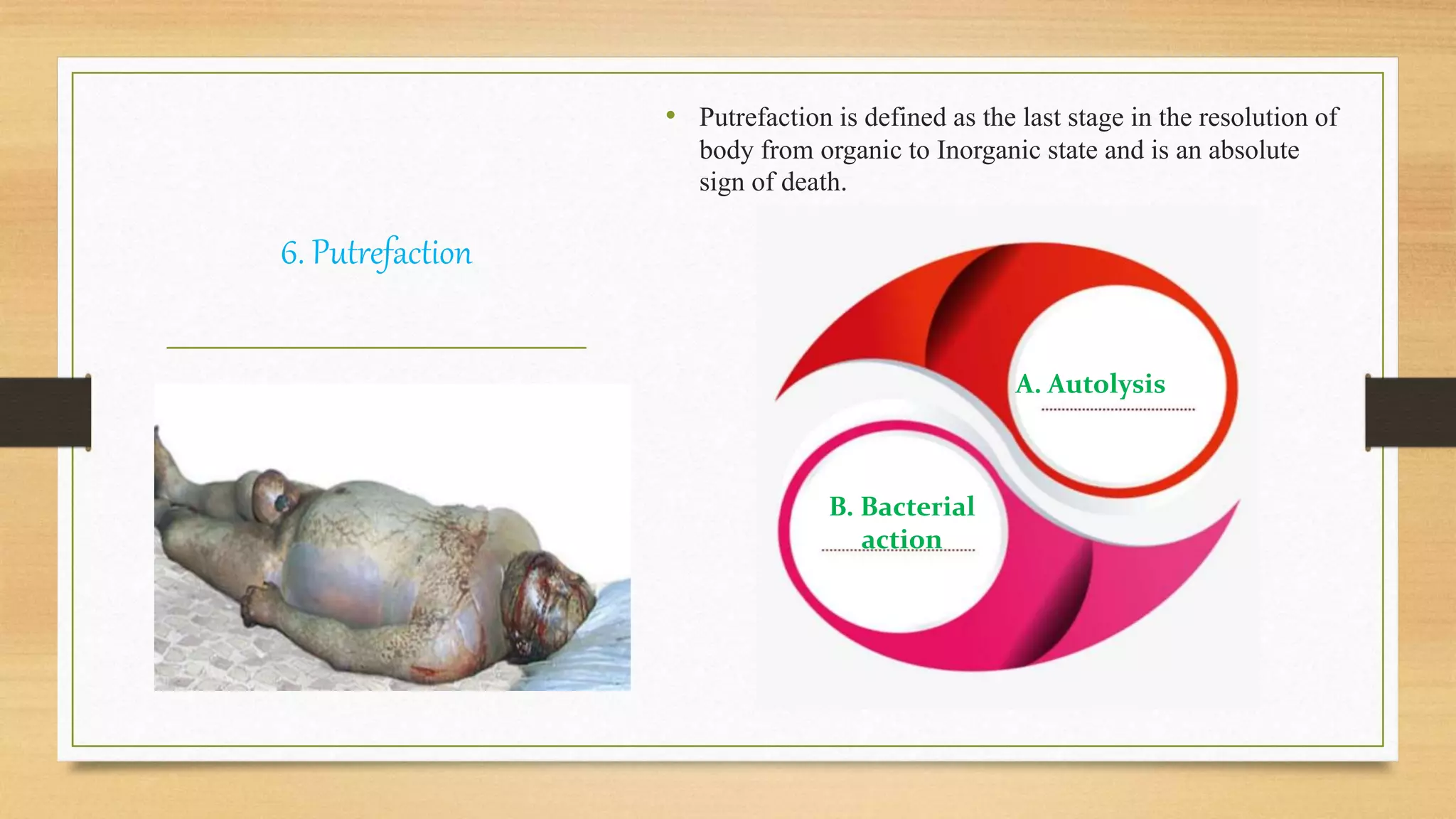 Medicolegal aspects of death | PPTX