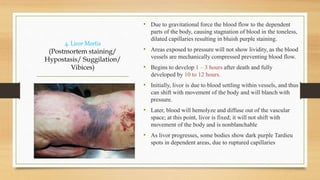 Medicolegal aspects of death | PPTX