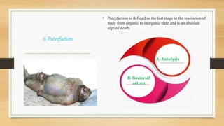 Medicolegal aspects of death | PPTX