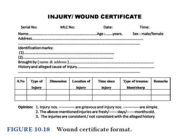 medico legal aspects of wound - forensic medicine | PPTX