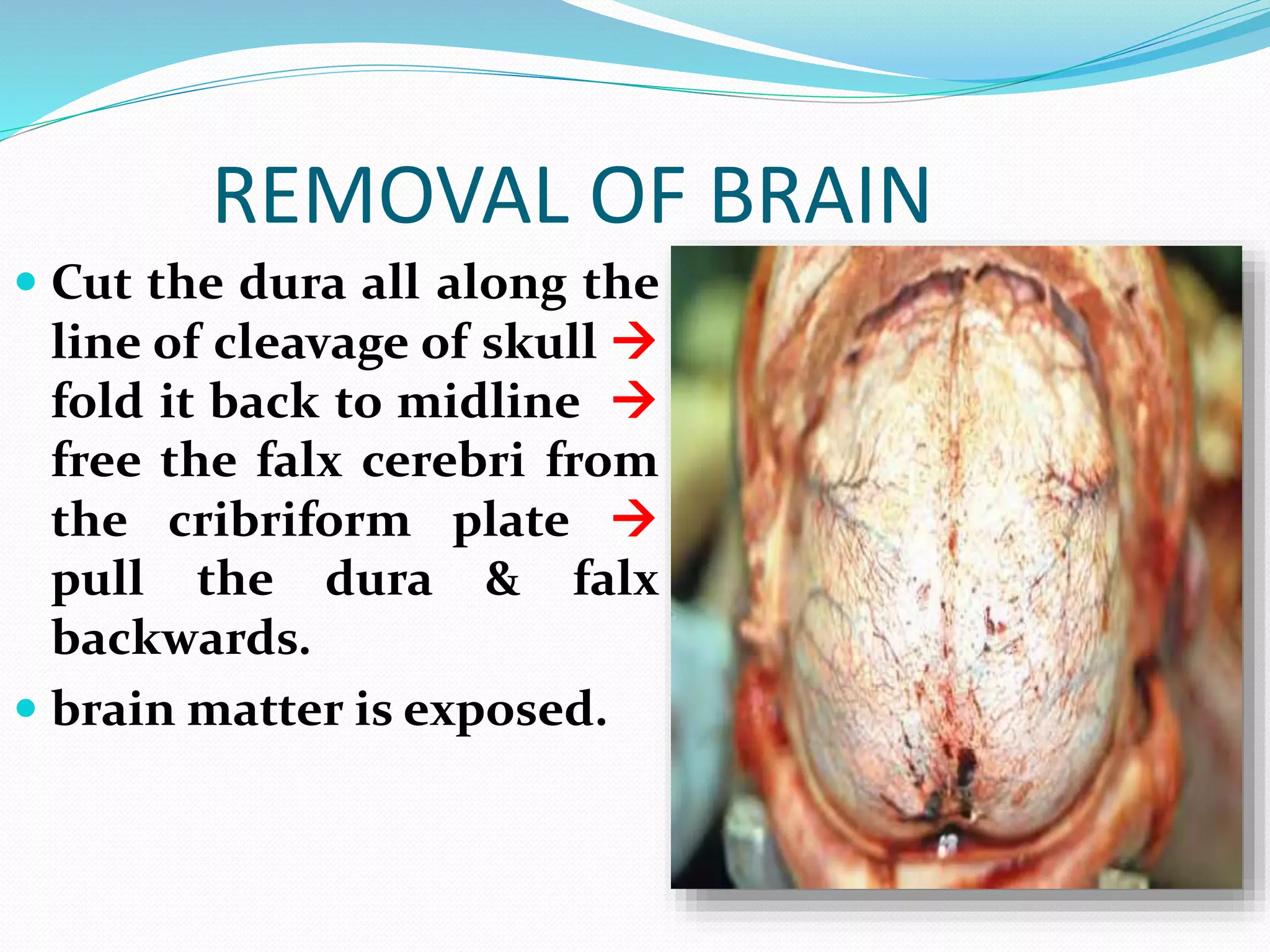 Medico-Legal Autopsy Techniques | PPTX
