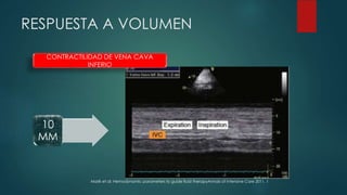 Medidas de respuesta a volumen (UCI) | PPTX