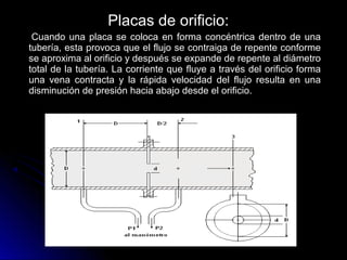 Medidores de flujo | PPT