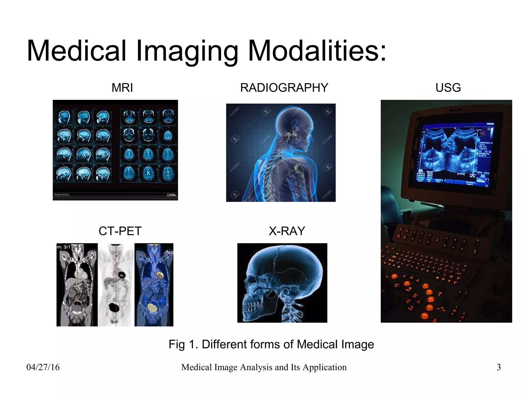Medical Image Analysis and Its Application | PPT