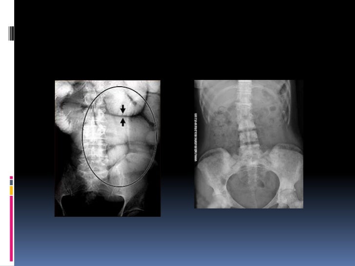 Medio de contraste radiologico - caribbeanloki