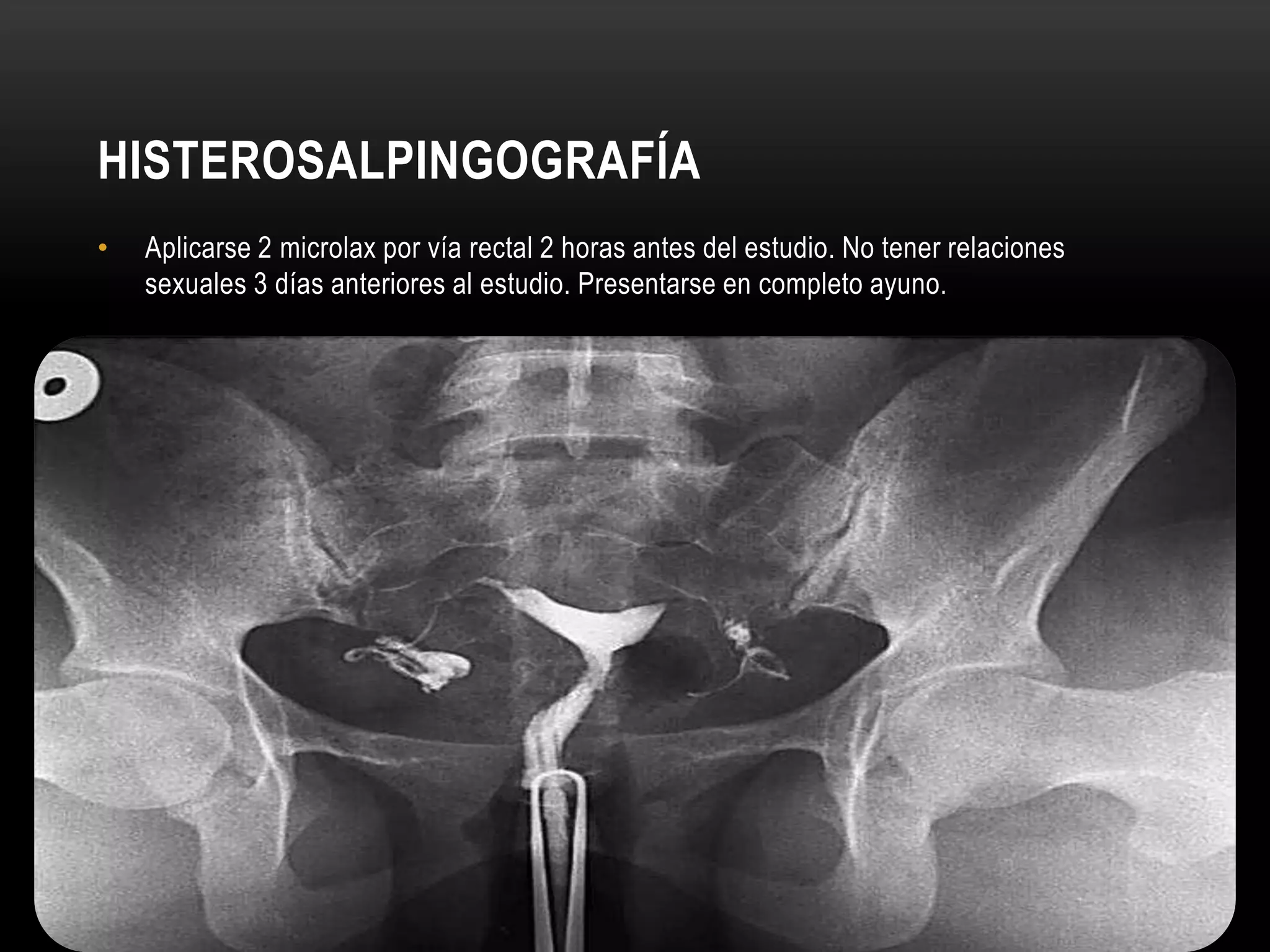 Tipos de Medios de Contraste Radiologicos | PPTX | Digestive Disorders ...