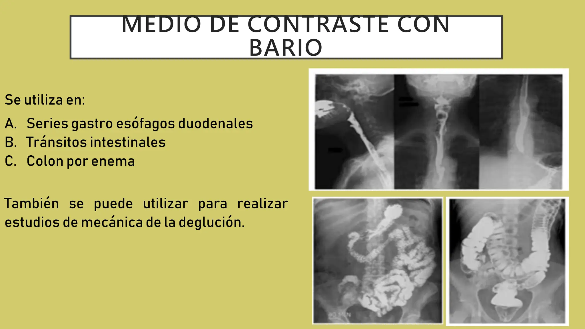 los MEDIOS DE CONTRASTE imagenologia medica | PPTX