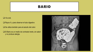 los MEDIOS DE CONTRASTE imagenologia medica | PPTX