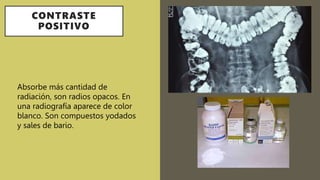 los MEDIOS DE CONTRASTE imagenologia medica | PPTX