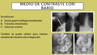 los MEDIOS DE CONTRASTE imagenologia medica | PPTX