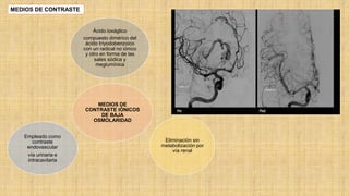 MEDIOS DE CONTRASTE. pptx | PPTX