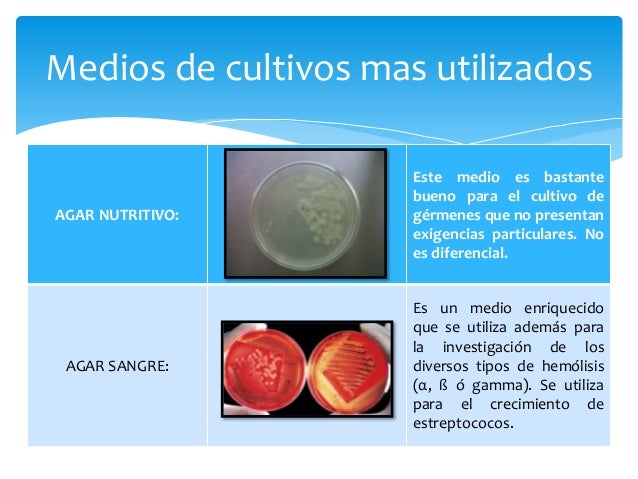 Medios de cultivo