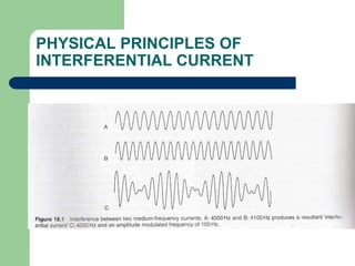 Medium Frequency Current.ppt