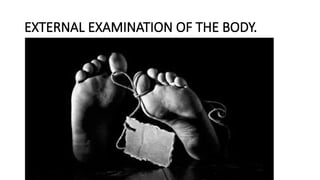 Med legal Autopsy - External Examination. | PPTX