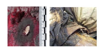 Med legal Autopsy - External Examination. | PPTX