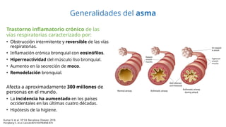 Enfermedades pulmonares obstructivas. Asma y EPOC | PPTX