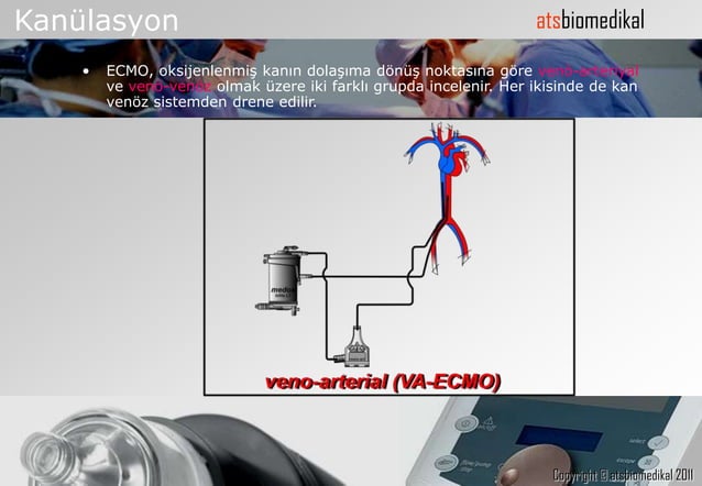 Medos ats biomedikal ecmo ecls | PPT