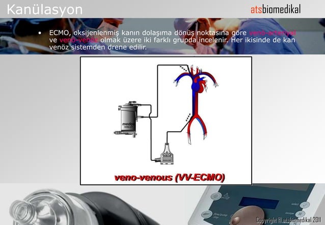 Medos ats biomedikal ecmo ecls | PPT