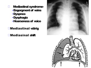 Med ppt.pptx