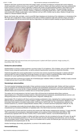 Down Syndrome (Medscape.com) | PDF