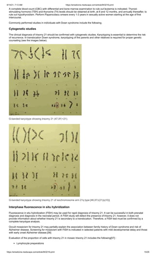 Down Syndrome (Medscape.com) | PDF