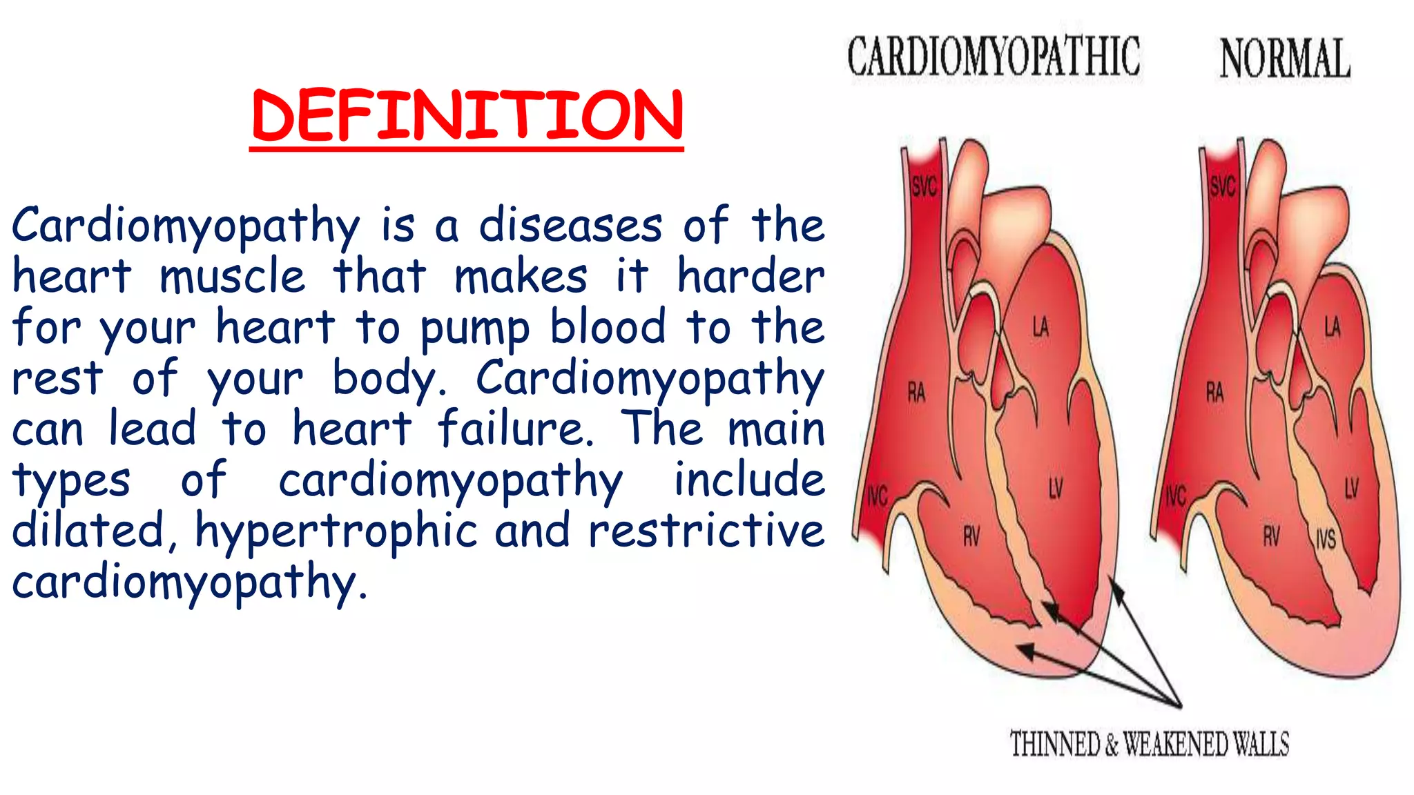 CARDIOMYOPATHY | PPTX