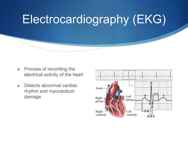 Cardiac Function Test | PPTX