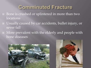 Med terms ch. 4 presentation | PPT