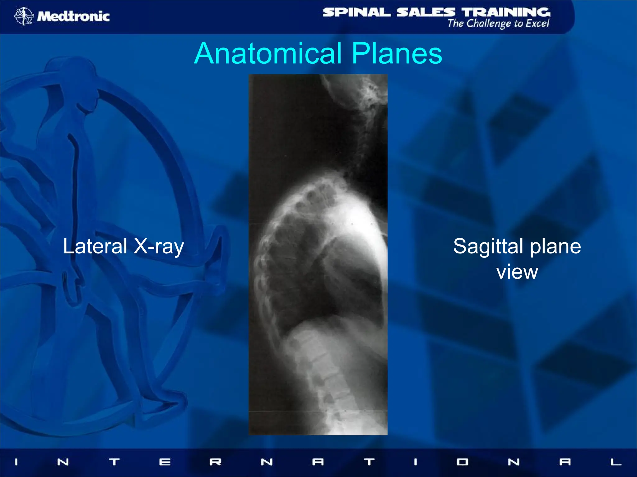 Medtronic Basics of Spinal Anatomy of human | PDF