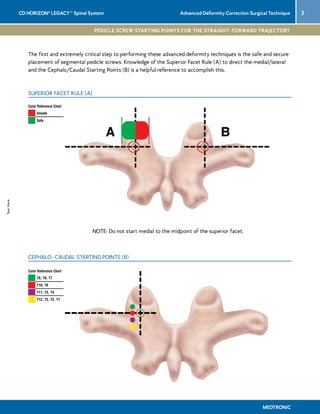 Medtronic cd horizonadvanceddeformityst | PDF