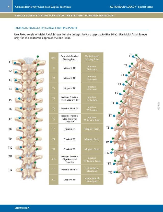 Medtronic cd horizonadvanceddeformityst