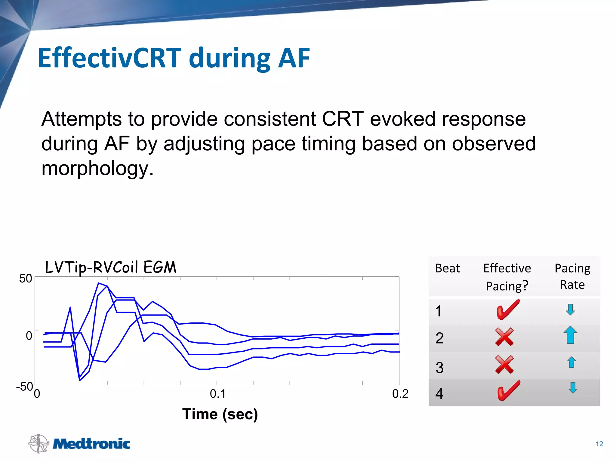 Medtronic international the future of cardiac resynchronisation therapy ...