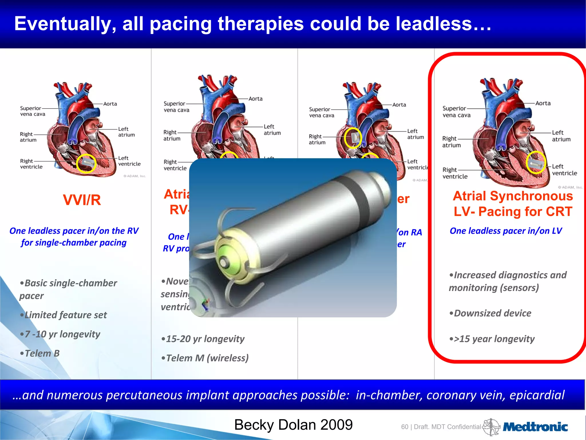 Medtronic international the future of cardiac resynchronisation therapy | PPT