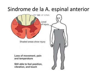 Medula espinal anatomía y patología | PPTX
