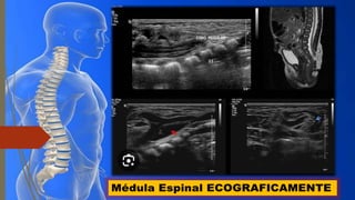 MEDULA ESPINAL.pptx
