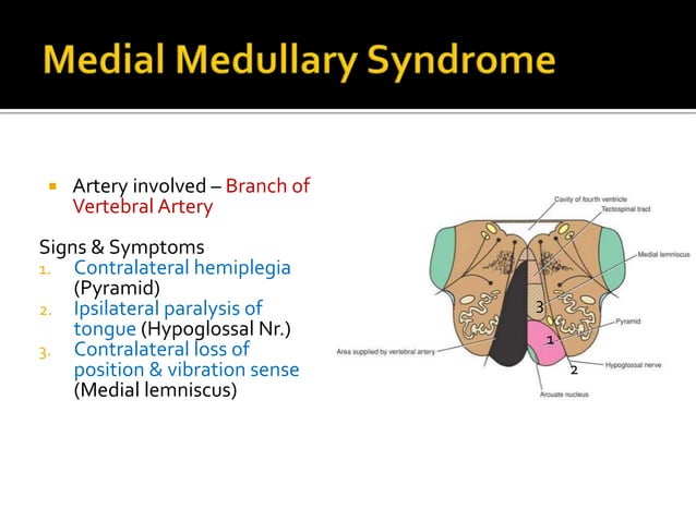 Anatomy of Medulla oblongata | PPT
