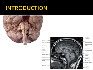 Anatomy of Medulla oblongata | PPTX